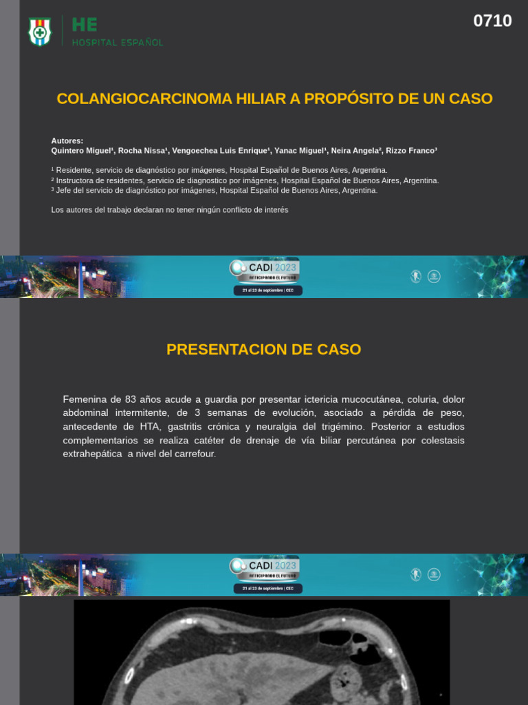 Colangiocarcinoma Hiliar: Caso Clínico | PDF | Neoplasias | Sistema ...