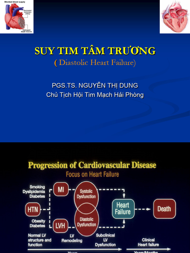File_SUY-TIM-TAM-TRUONG.Dung | PDF