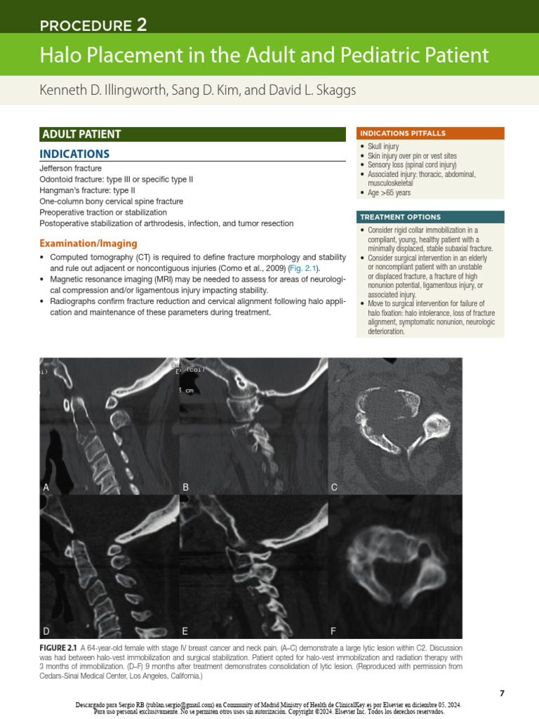 Procedure. Halo | PDF | Surgery | Medical Imaging