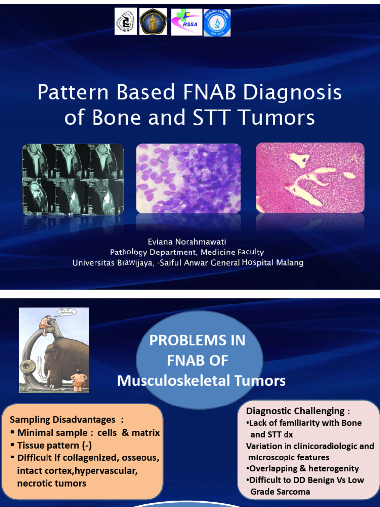 FNAB Diagnosis of Bone and STT Tumors | PDF | Cartilage | Mitosis