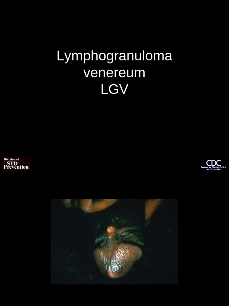 Understanding Lymphogranuloma Venereum | PDF