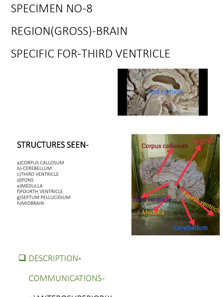Anatomy of the Third Ventricle | PDF