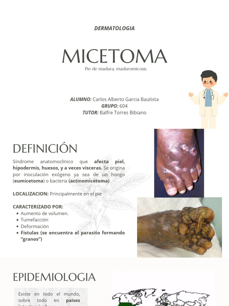 Micetoma Carlos Garcia 604 Dermatologia | PDF | Histopatología ...