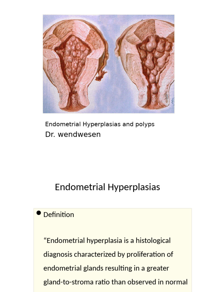 5.1Endometrial Hyperplasia | PDF | Hormone Replacement Therapy | Estrogen