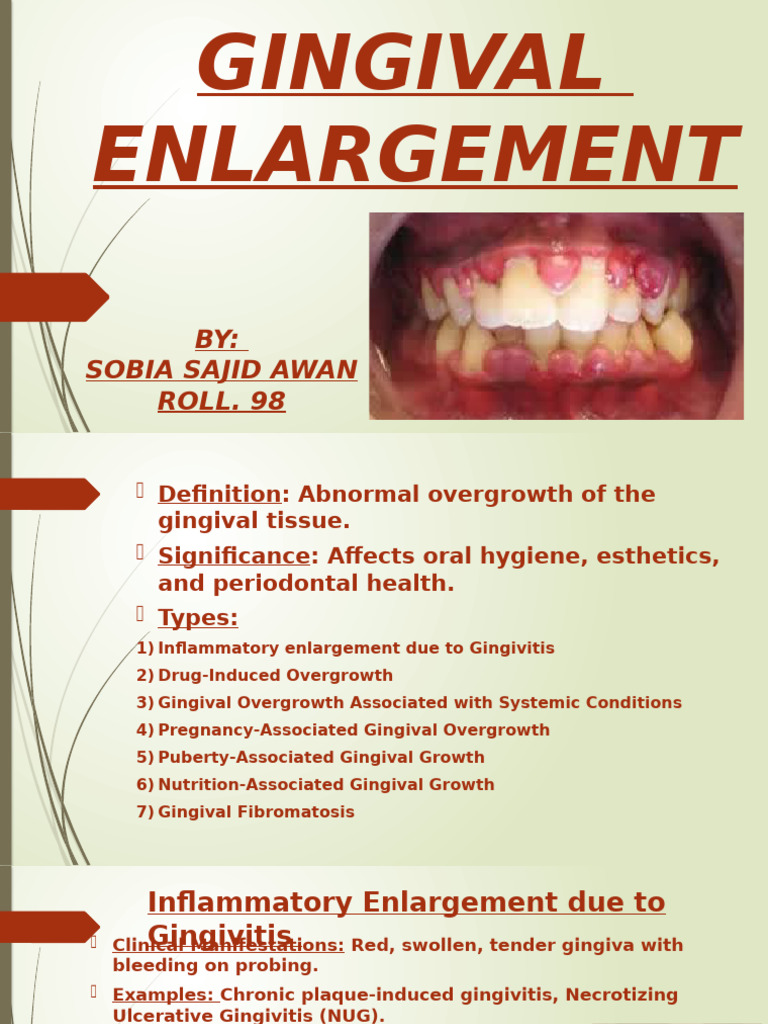Perio Presentation - Gingival Enlargement. | PDF | Periodontology | Inflammation