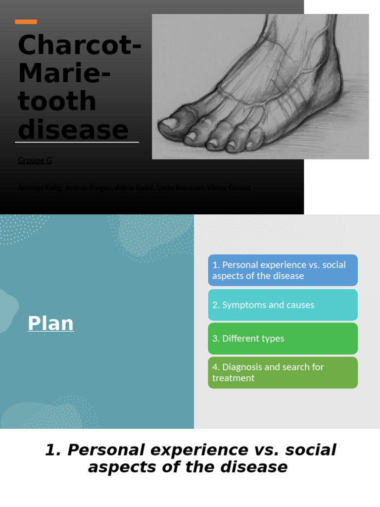 Charcot Marie Tooth Diapo | PDF