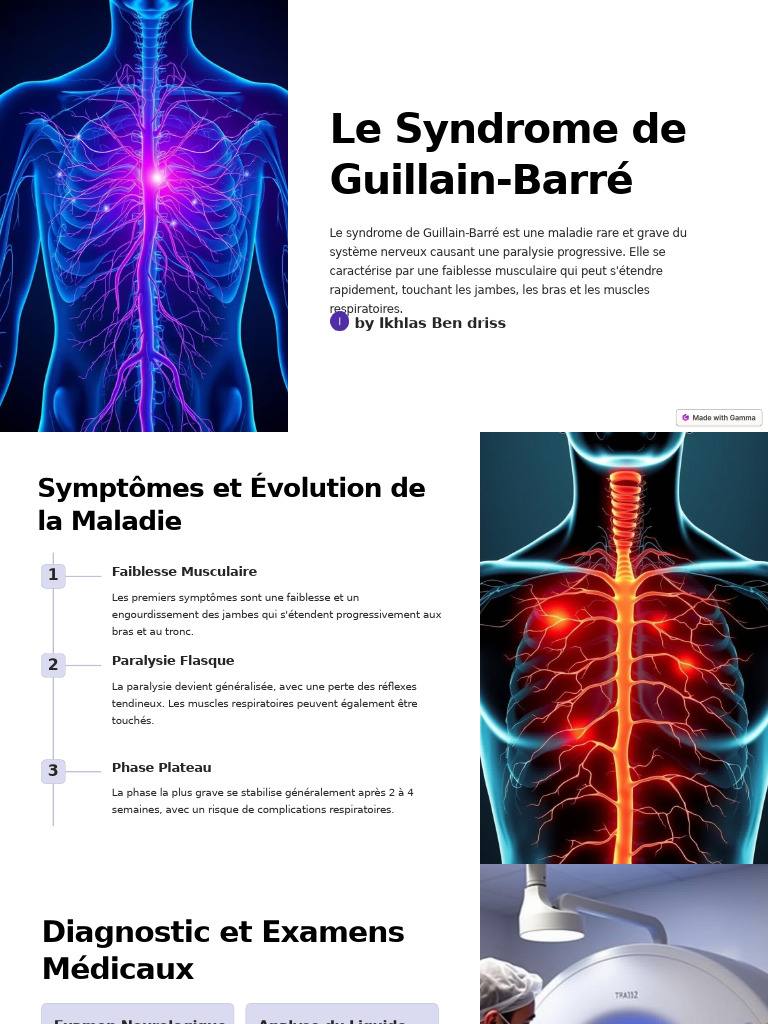 Le-Syndrome-de-Guillain-Barre | PDF | Médecine clinique | Maladies et troubles