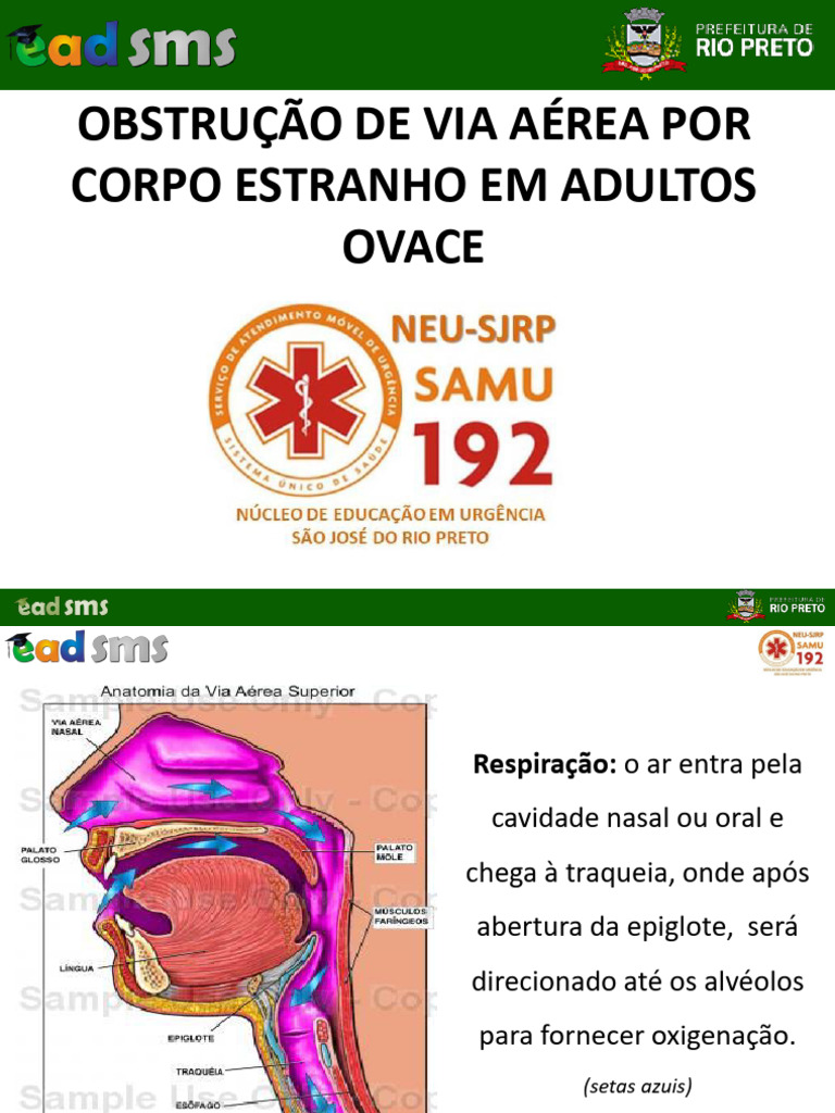 Ovace Adulto e Ped - Samu 2024 | PDF