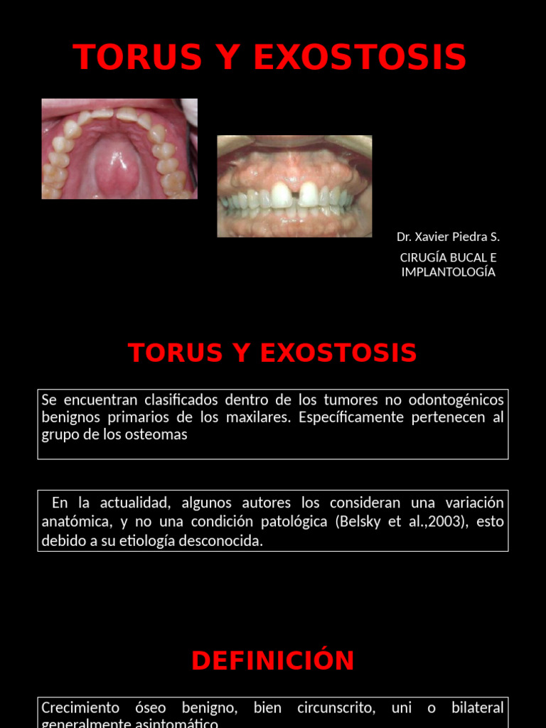 10. TORUS Y EXOSTOSIS | PDF | Cirugía | Hueso