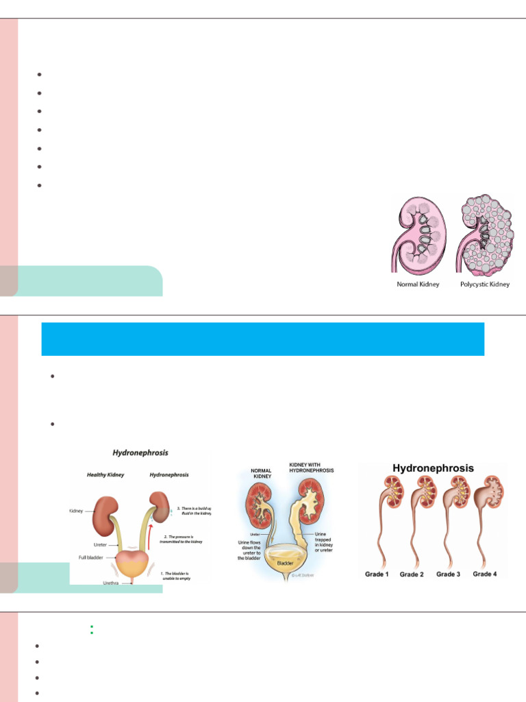 L5 - Diseases of The Kidney and Ureter - P2 - Removed | PDF | Urinary Tract Infection | Urology