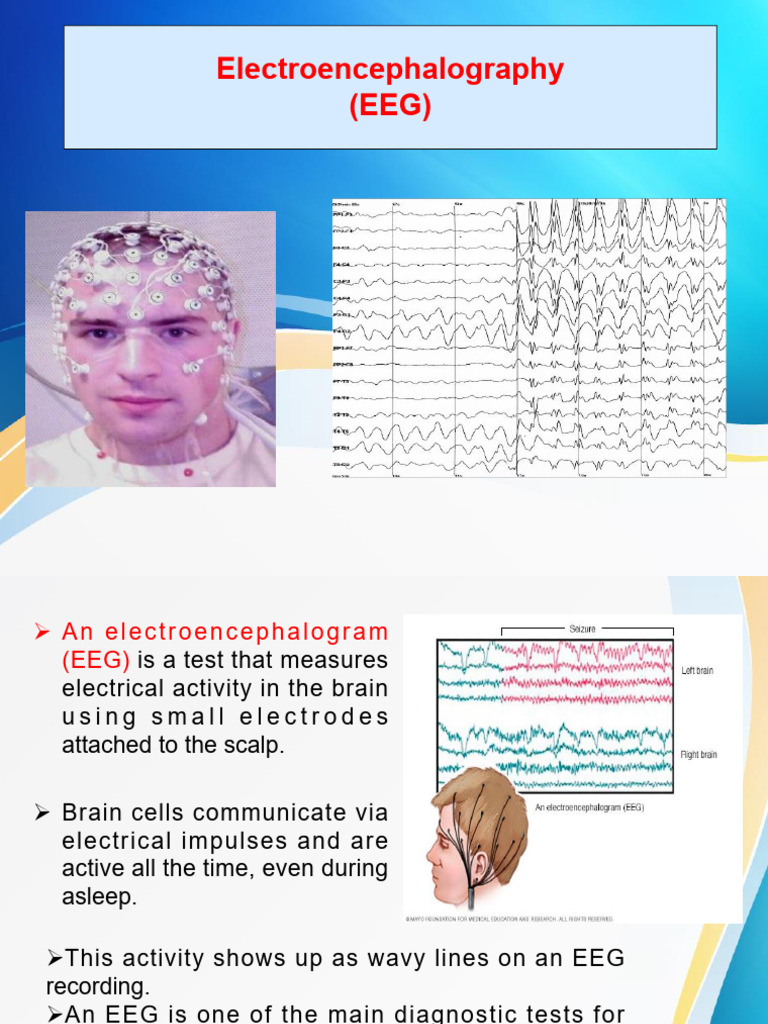 14 EEG | PDF | Electroencephalography | Sleep