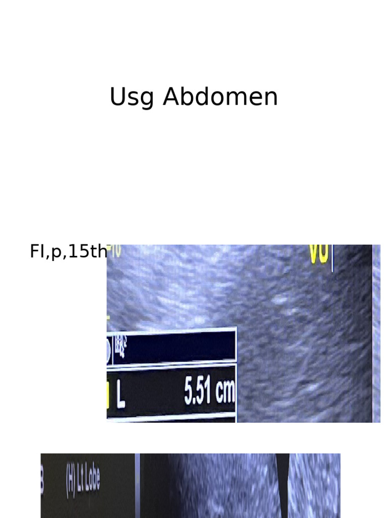 Usg MG 4 | PDF