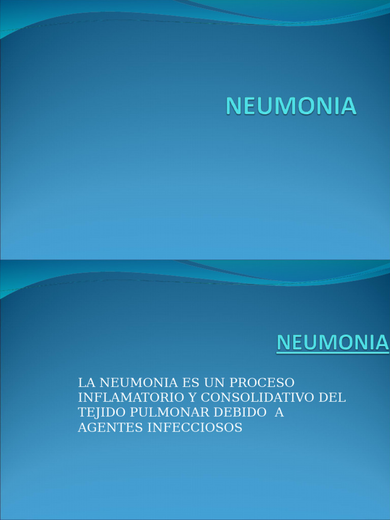 Neumonia Nac Nha | PDF | Neumonía | Tos