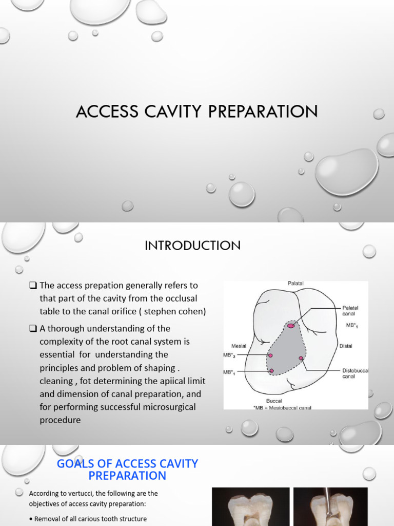 ACCESS CAVITY PREPARATION | PDF | Dentistry | Mouth