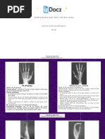RX de Mano Frente | PDF | Mano | Anatomía