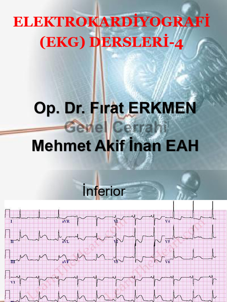 Ekg 4 | PDF