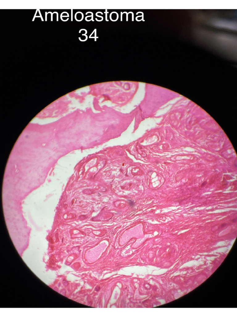 Pathology All Slides | PDF