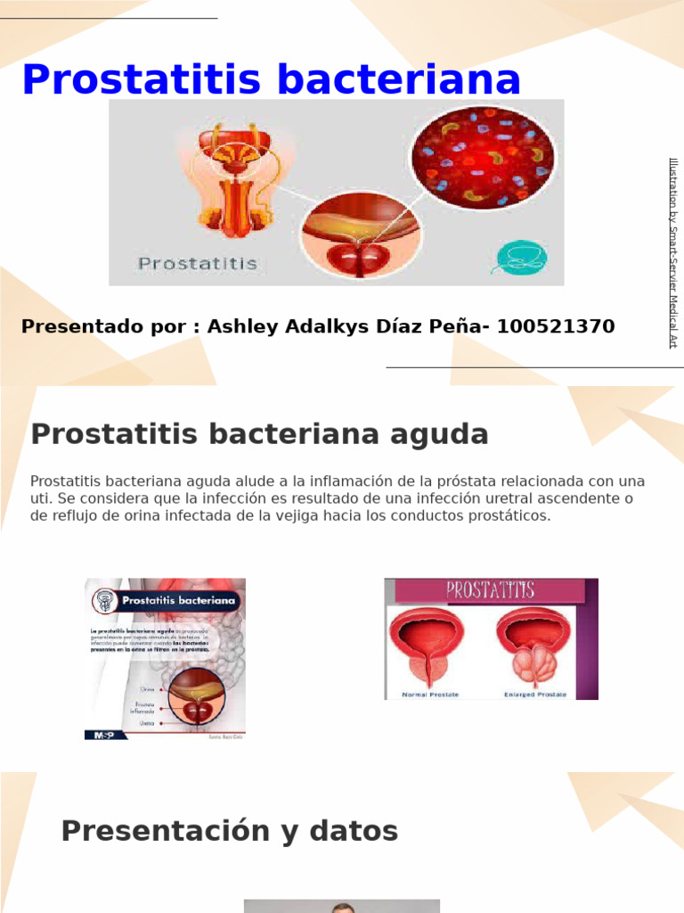 Prostatitis Bacteriana: Diagnóstico y Tratamiento | PDF | Medicina ...