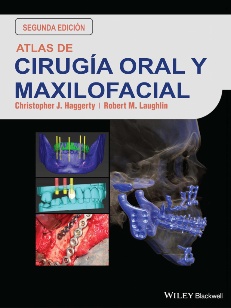 DEMO Atlas de Cirugía Oral y Maxilofacial | PDF | Implante dental | Ortodoncia