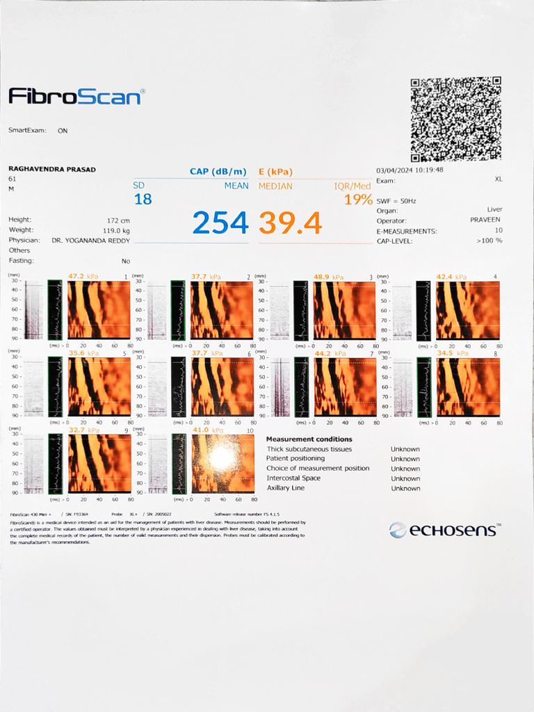 Fibro Scan | PDF
