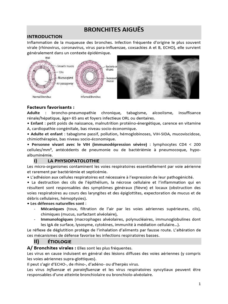 Comprendre la bronchite aiguë : causes et traitements | PDF ...