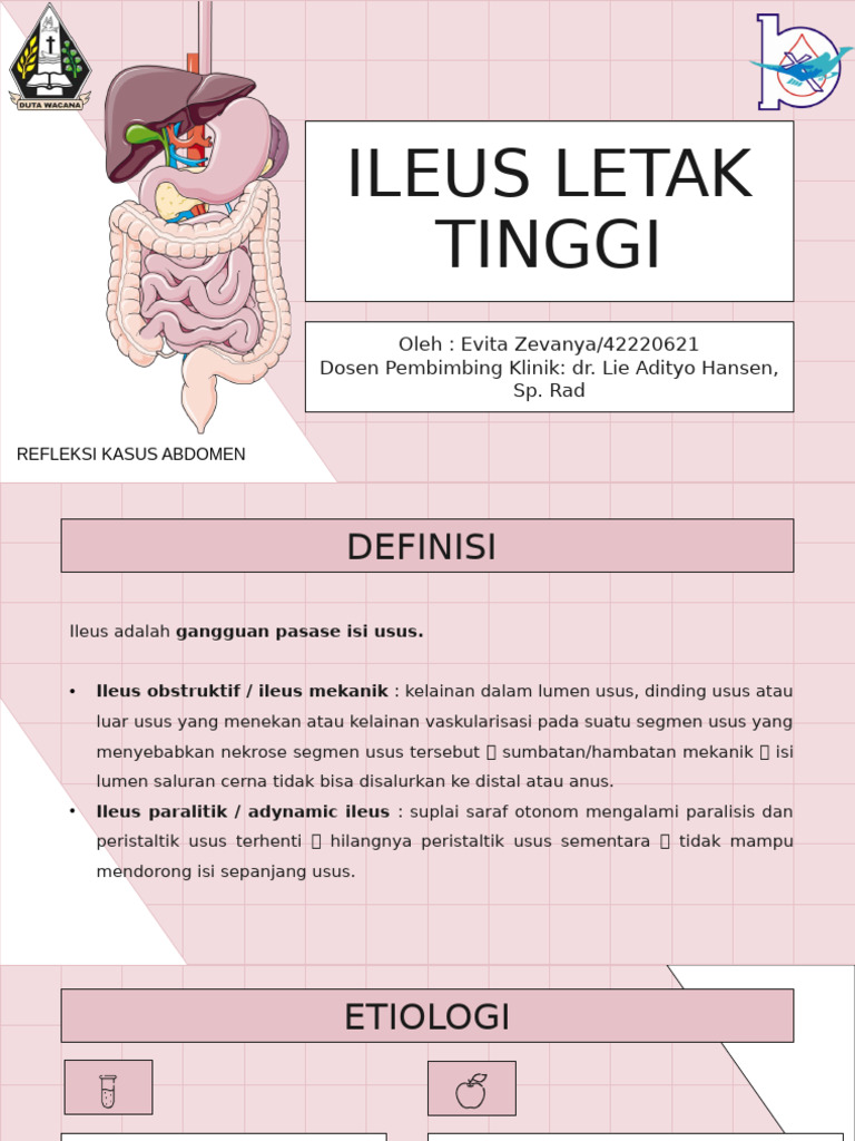 Radiologi : Ileus Letak Tinggi | PDF