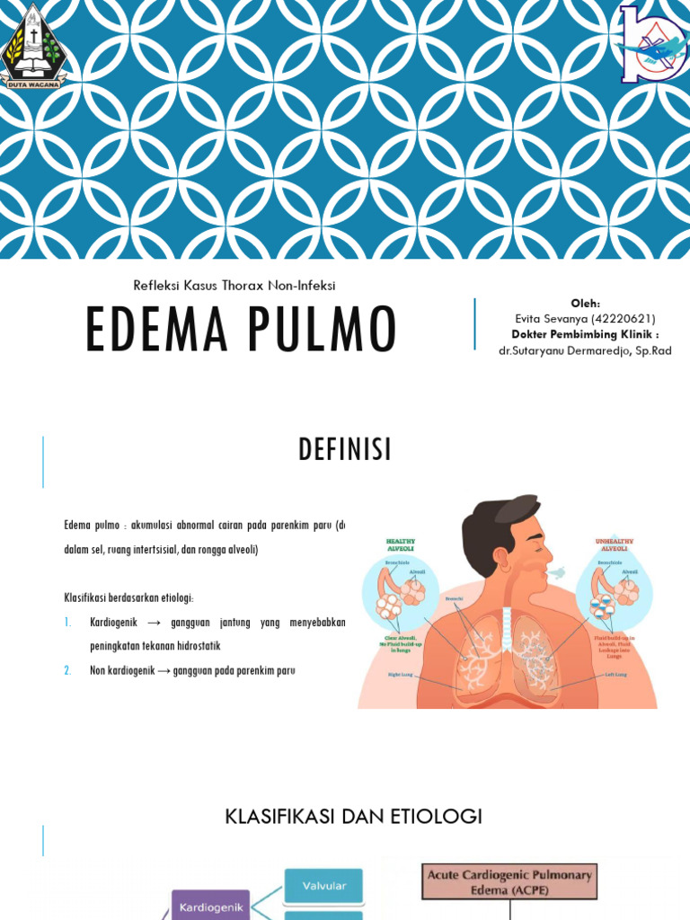 Radiologi Thorax Non-Infeksi: Edema Paru | PDF