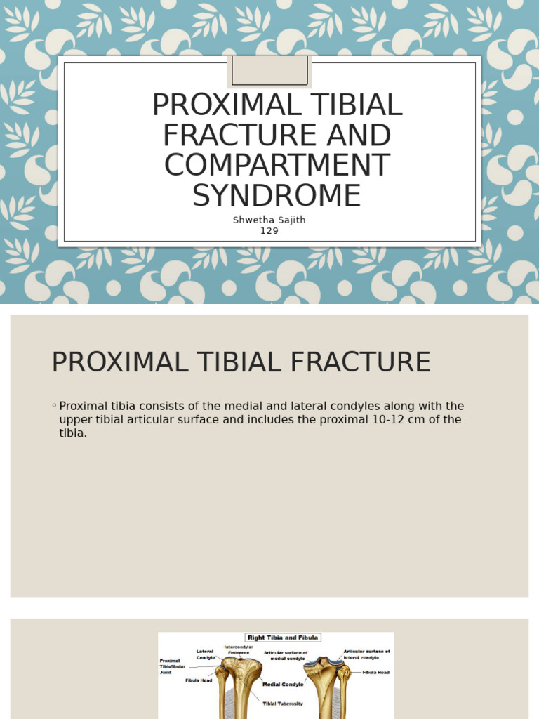 Proximal Tibial Fracture Overview | PDF | Knee | Musculoskeletal System