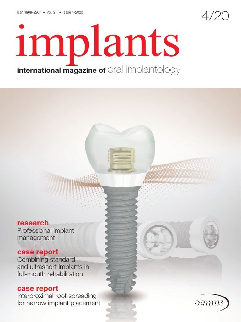 Implants 2020-04 | PDF | Periodontology | Dental Implant