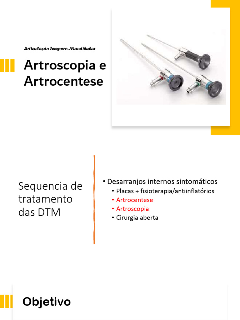 Artroscopia e Artrocentese na ATM | PDF | Dor | Medicina Clínica