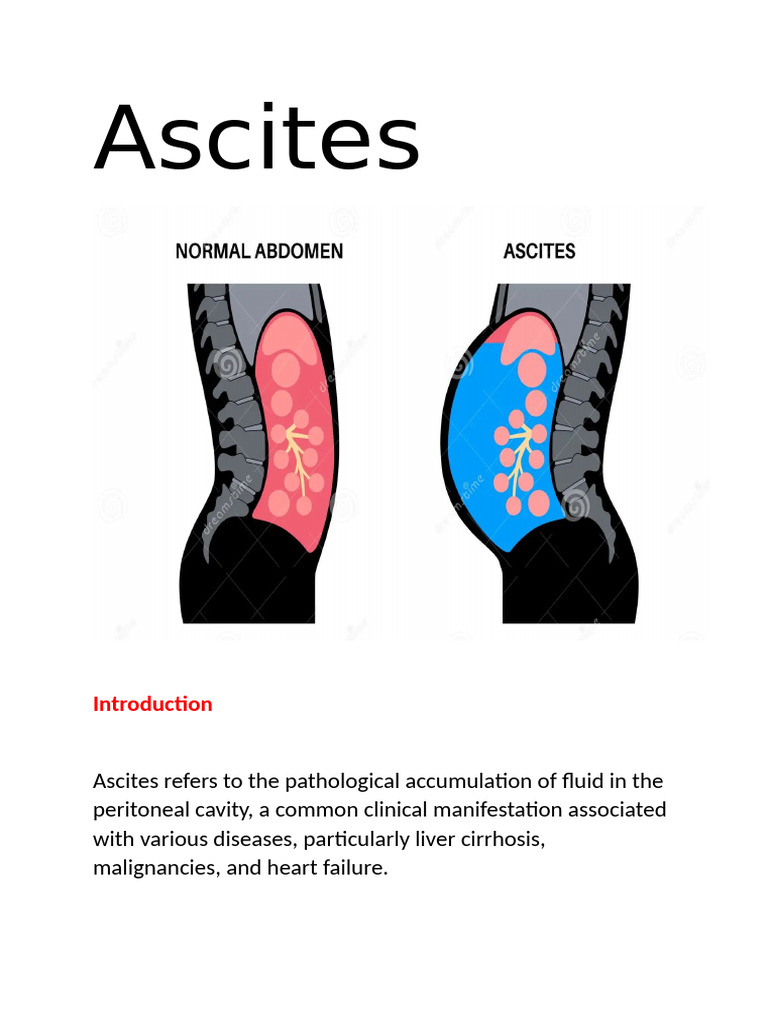 Ascites | PDF | Cirrhosis | Medicine