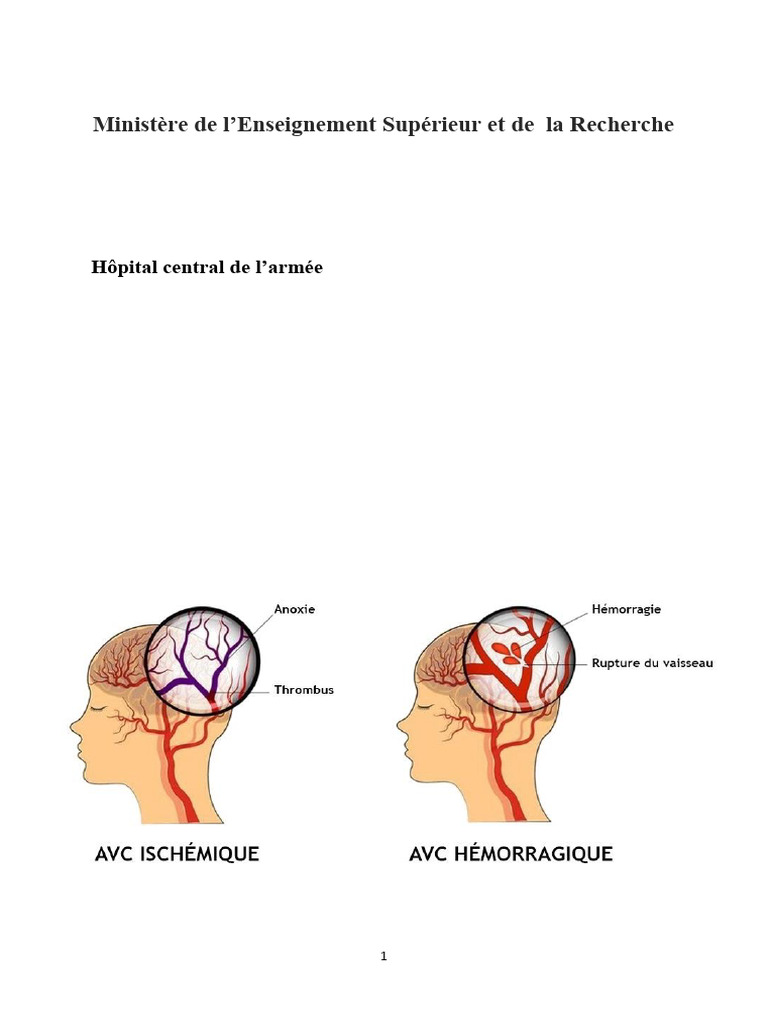 AVC : Définitions et Types Principaux | PDF | Accident vasculaire ...