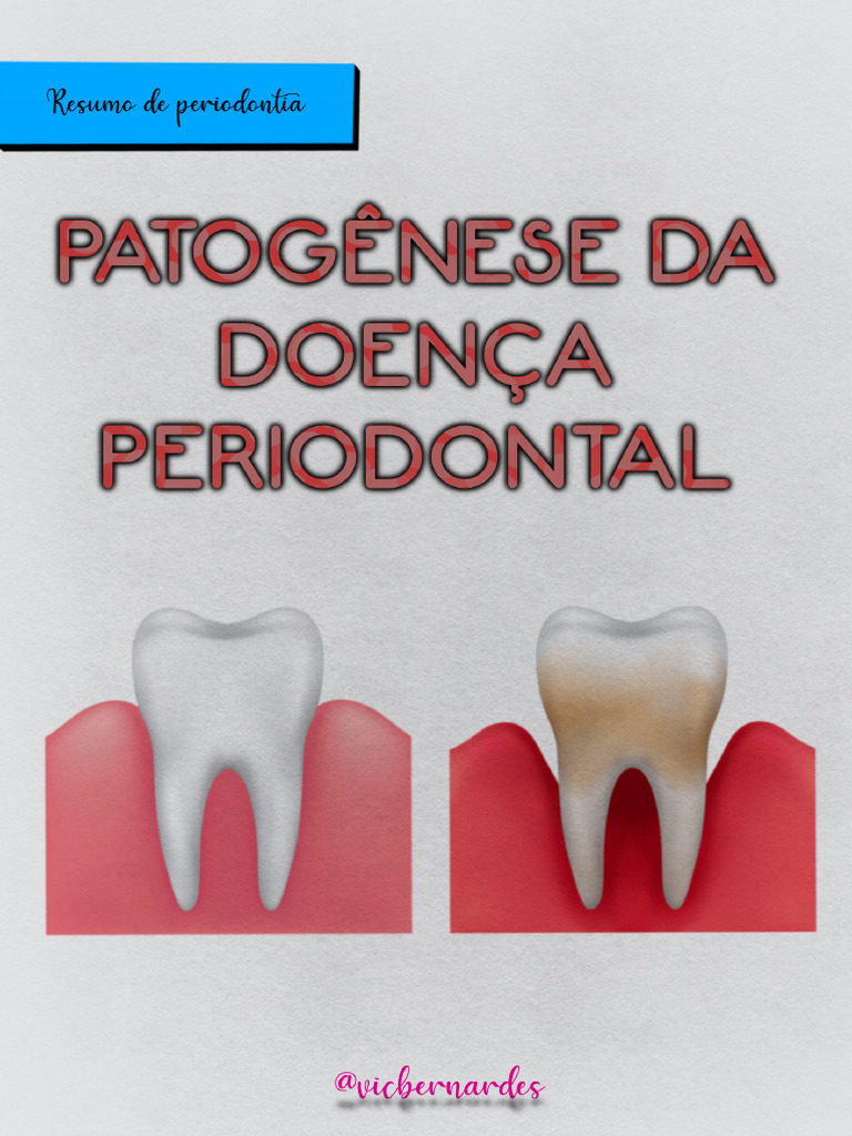 Patogenese Da Doença Periodontal | PDF
