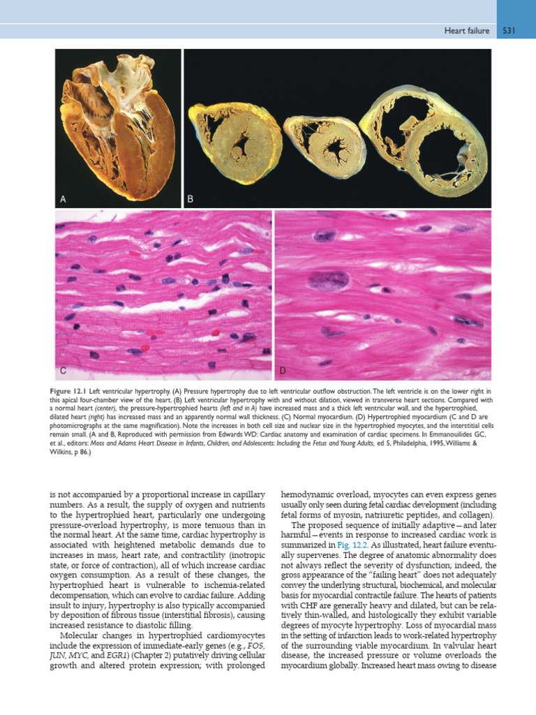 Robbins - Cotran Pathologic Basis of Disease, 10th Edition-536 | PDF ...