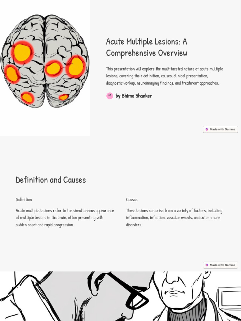 Acute Multiple Lesions A Comprehensive Overview | PDF | Neurology ...