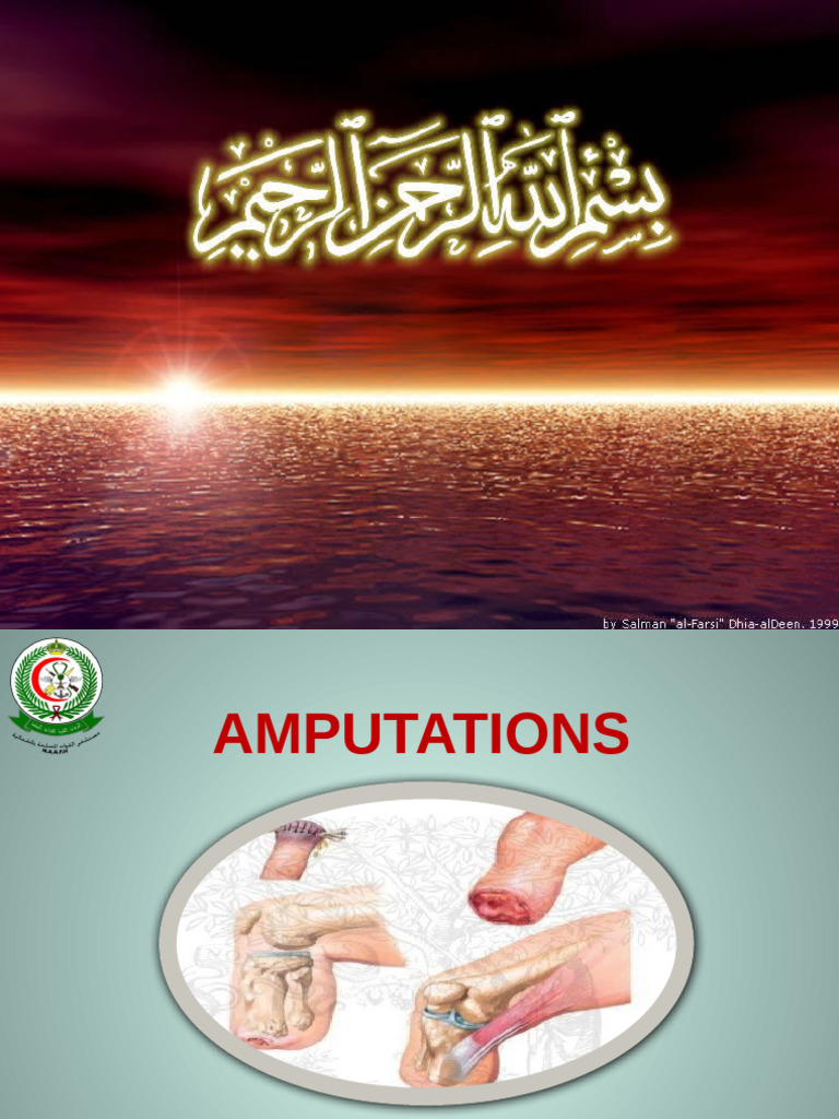 Amputations Presentation | PDF | Amputation | Clinical Medicine