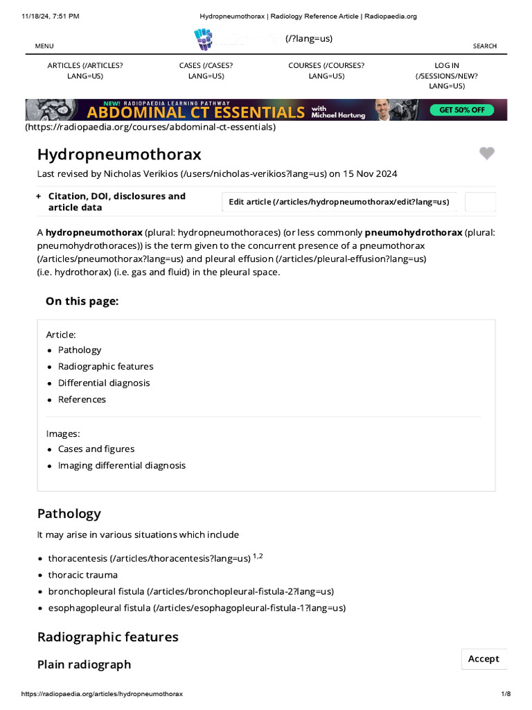14 Hydropneumothorax _ Radiology Reference Article _ Radiopaedia.org ...