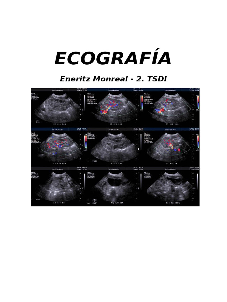 Ecografía: Eneritz Monreal - 2. TSDI | PDF