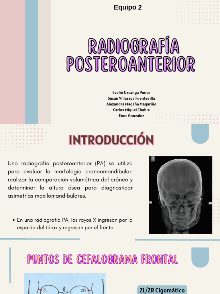 Radiografía Posteroanterior en Cráneo | PDF | Anatomía humana