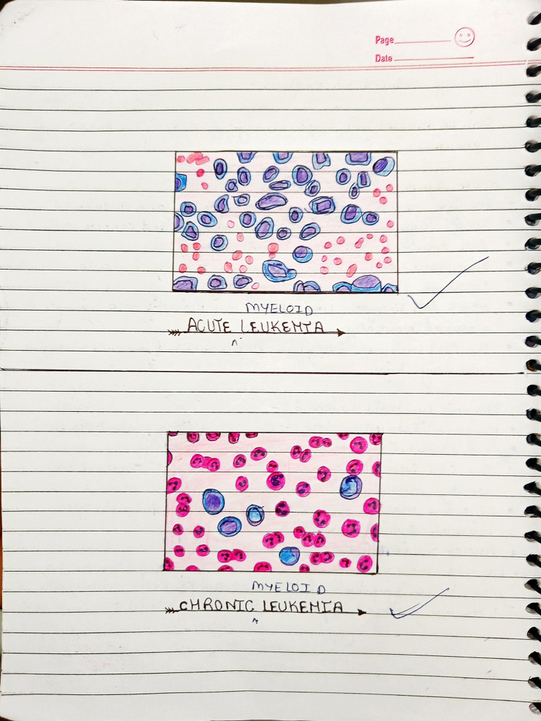Leukemia Diagram | PDF