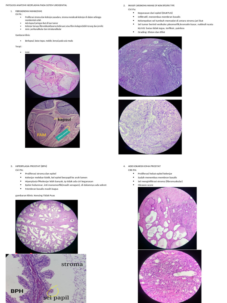 Patologi Anatomi Neoplasma Pada Sistem Urogenital | PDF