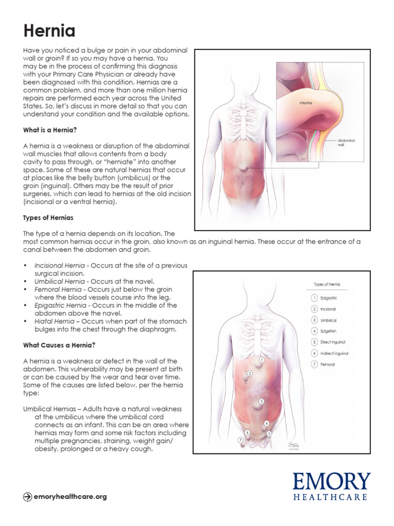 hernia-explained | PDF | Medical Specialties | Clinical Medicine