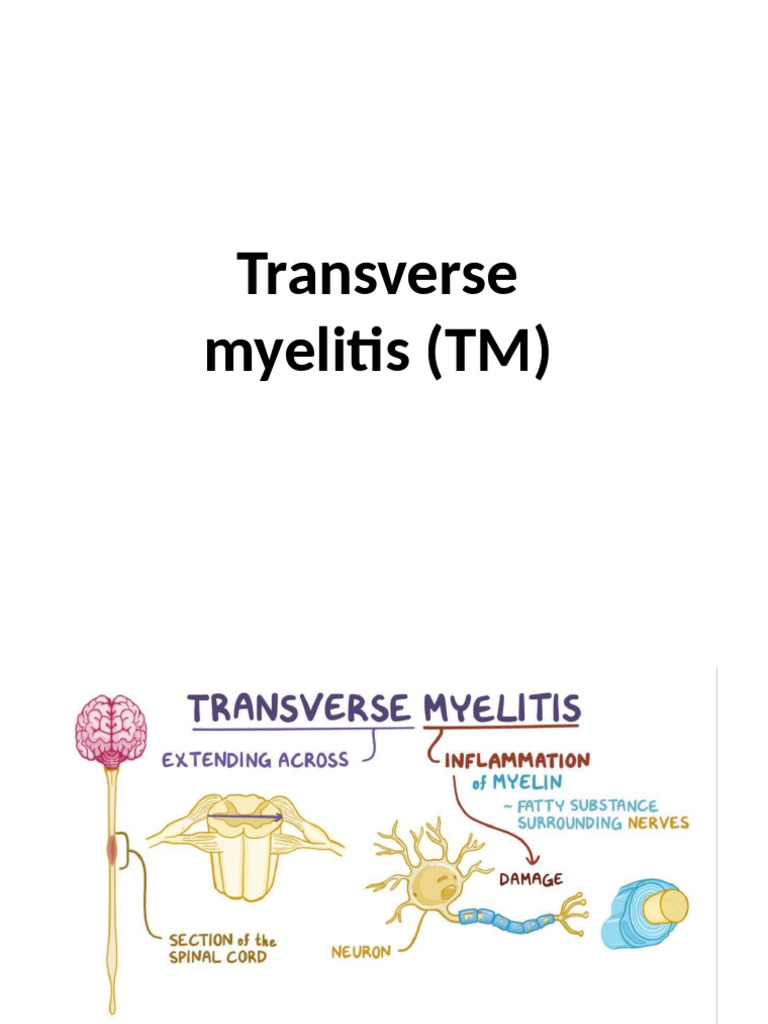 Acute Transverse Myelitis Overview | PDF | Medicine | Diseases And ...