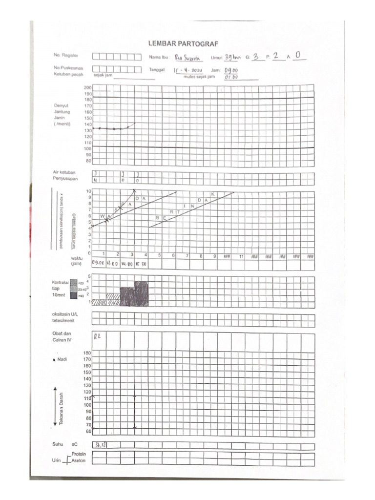 Lembar Partograf | PDF