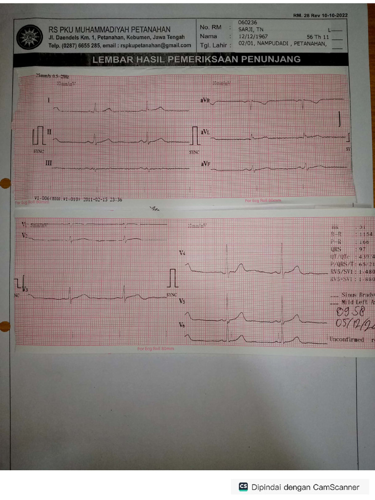 EKG Tn. Sarji | PDF