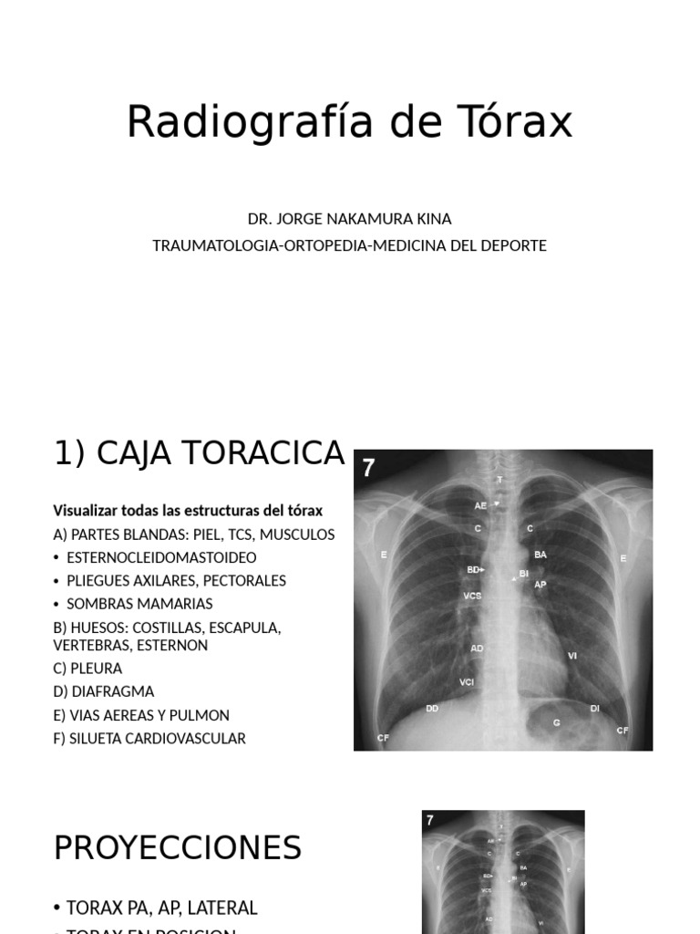 Guía de Radiografía de Tórax | PDF | Pulmón | Aorta