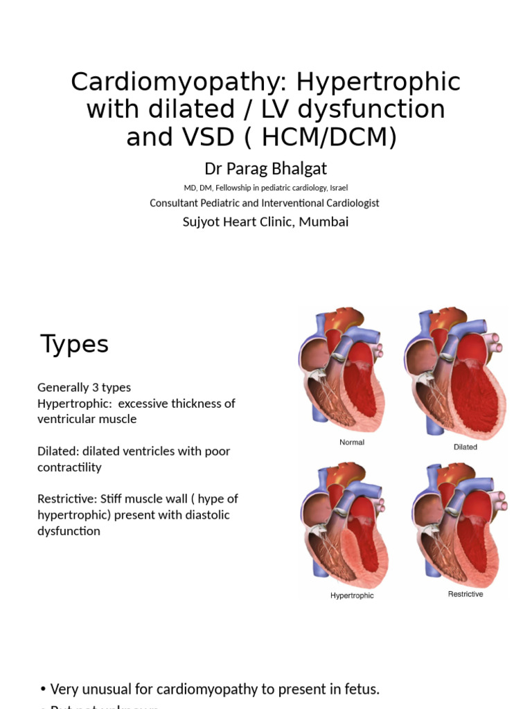 Pediatric Cardiomyopathy Types and Diagnosis | PDF