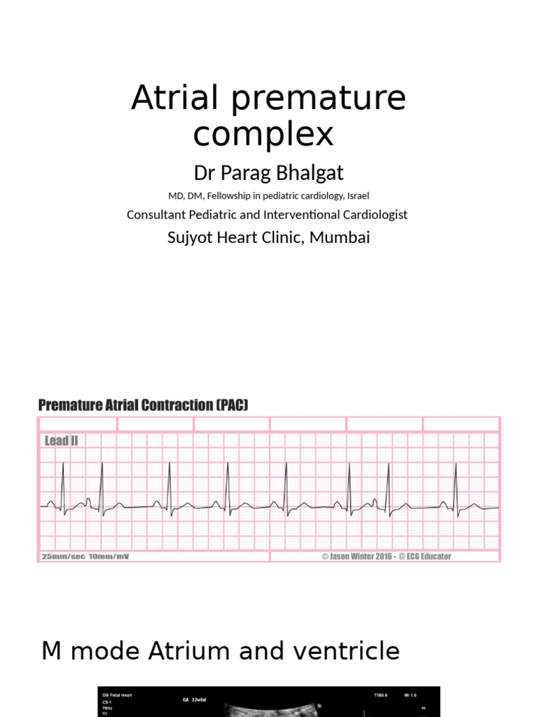17 Rhythm 1 APC VPC CHB Fetal | PDF