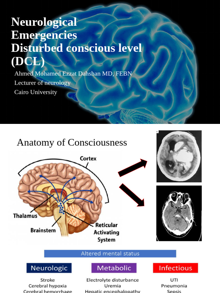 Neurological emergencies for non-neurologist - DCL | PDF | Traumatic ...