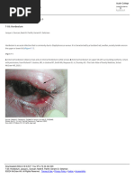 Stye | PDF | Ophthalmology | Rtt